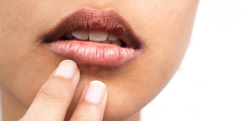Peeling Or Chapped Lips Something You Eat Might Be To Blame Yourtango