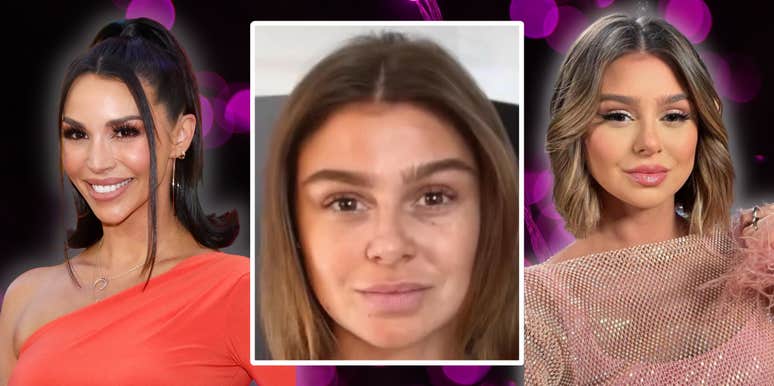 Is Raquels Black Eye Real Images Claim Vanderpump Rules Star Lied