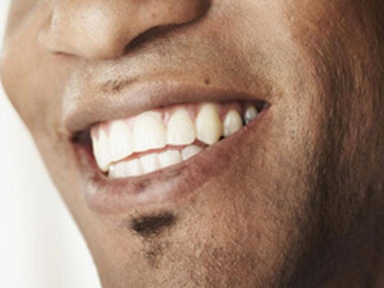 7 Ways To Get Your Man To Go To The Dentist Yourtango